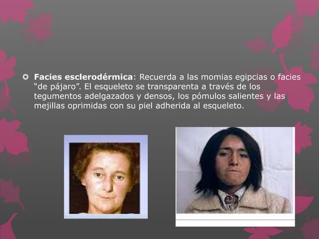 Tipos de facies | PPTX