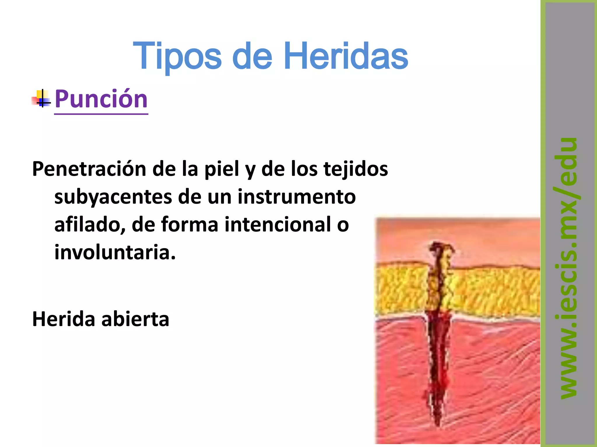 TIPOS DE HERIDAS | PPTX