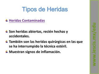 TIPOS DE HERIDAS | PPTX