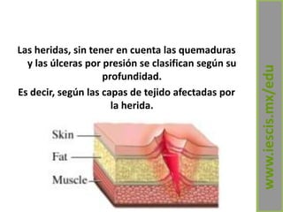 TIPOS DE HERIDAS | PPTX