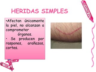 Tipos de heridas | PPTX