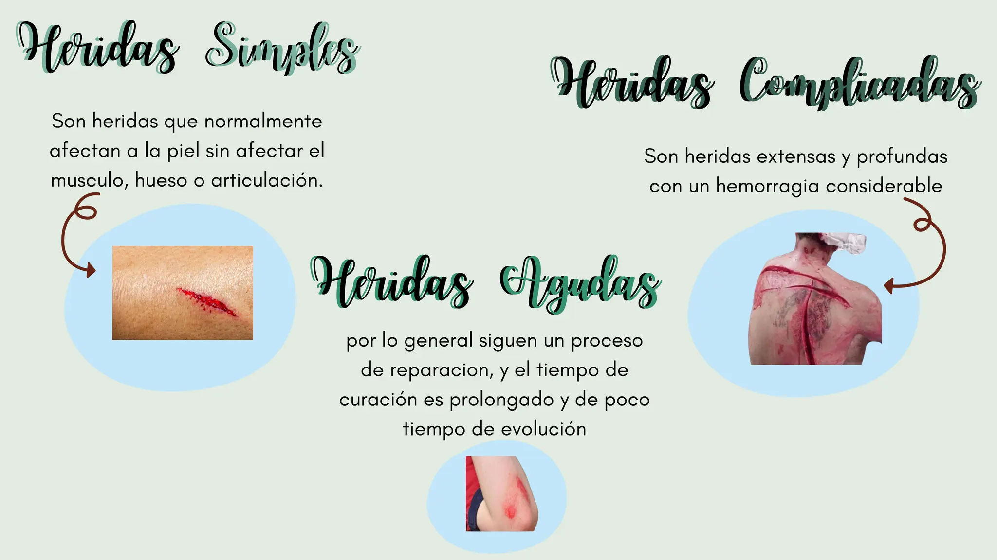 Tipos de Heridas.pdf abiertas y cerradas | PDF