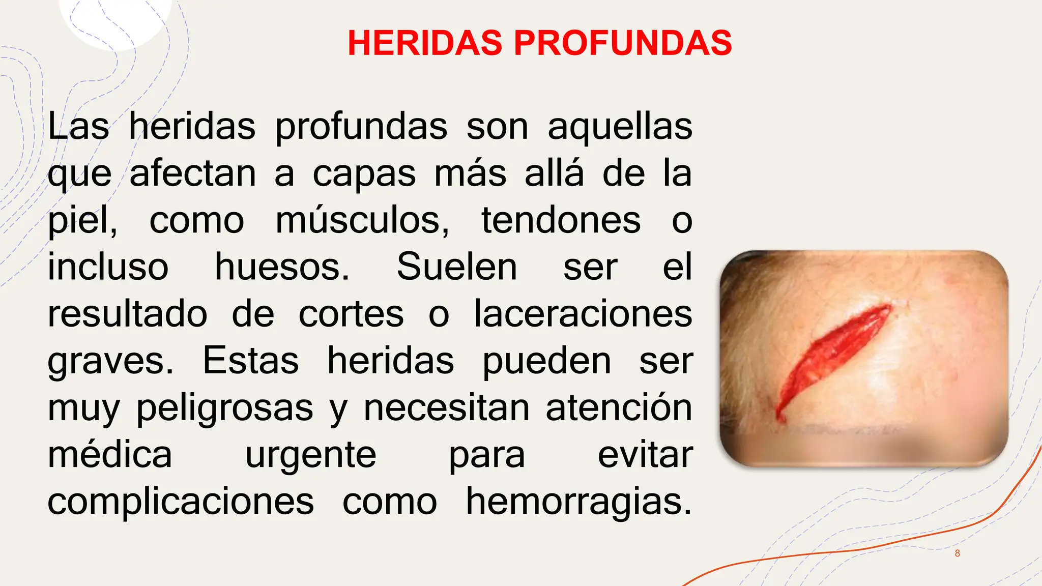 todos los tipos de heridas Y su tratamiento | PPTX | First Aid | Injuries