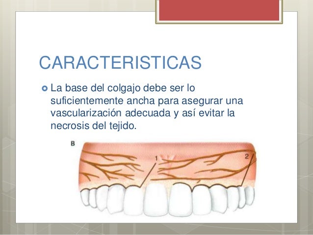 Tipos de incisión y colgajos