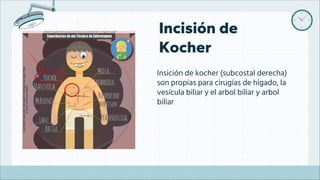 TIPOS DE INCISION QUIRUGICA PARA INSTRUMENTAR.pdf