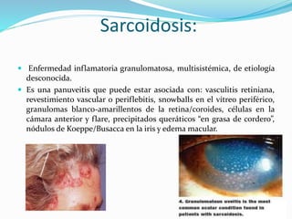 Tipos de inflamación | PPTX