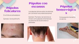 Tipos de lesiones en la piel.pptx