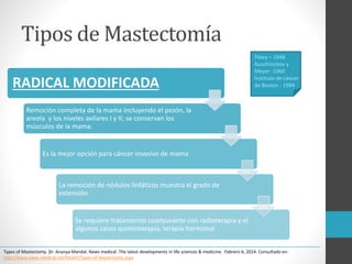 TIPOS DE MASTECTOMÍA