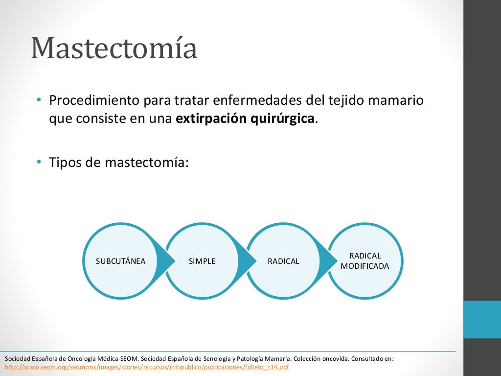 TIPOS DE MASTECTOMÍA
