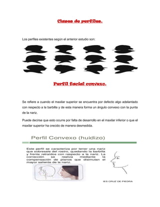 TIPOS DE MORDIDA Y PERFILES.pdf