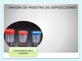 Tipos de muestras, para exámenes en laboratorio | PPTX