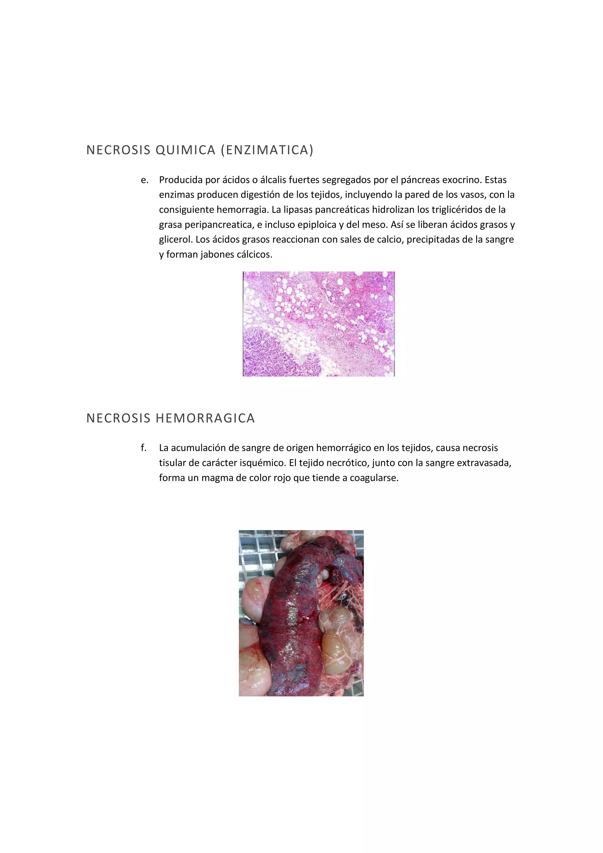 Tipos de Necrosis | PDF | Medical Health
