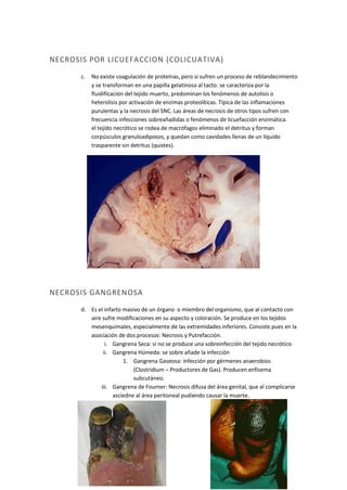 Tipos de Necrosis | PDF