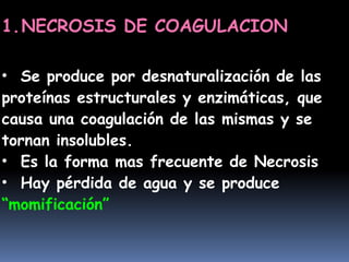 Tipos de Necrosis y cómo tratarla correctamente | PDF