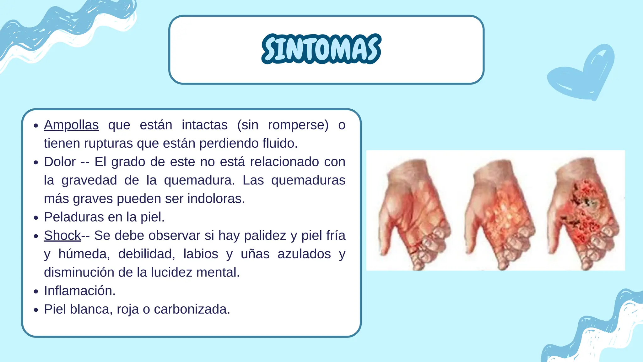 TIPOS DE QUEMADURAS E INTERVENCIONES DE ENFERMERÍA.pdf