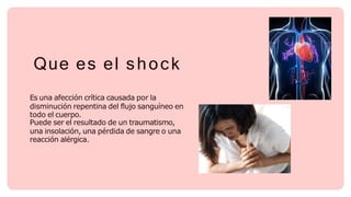 DEFINICION DE LOS ENUMERADOS TIPOS DE SHOCK | PPTX