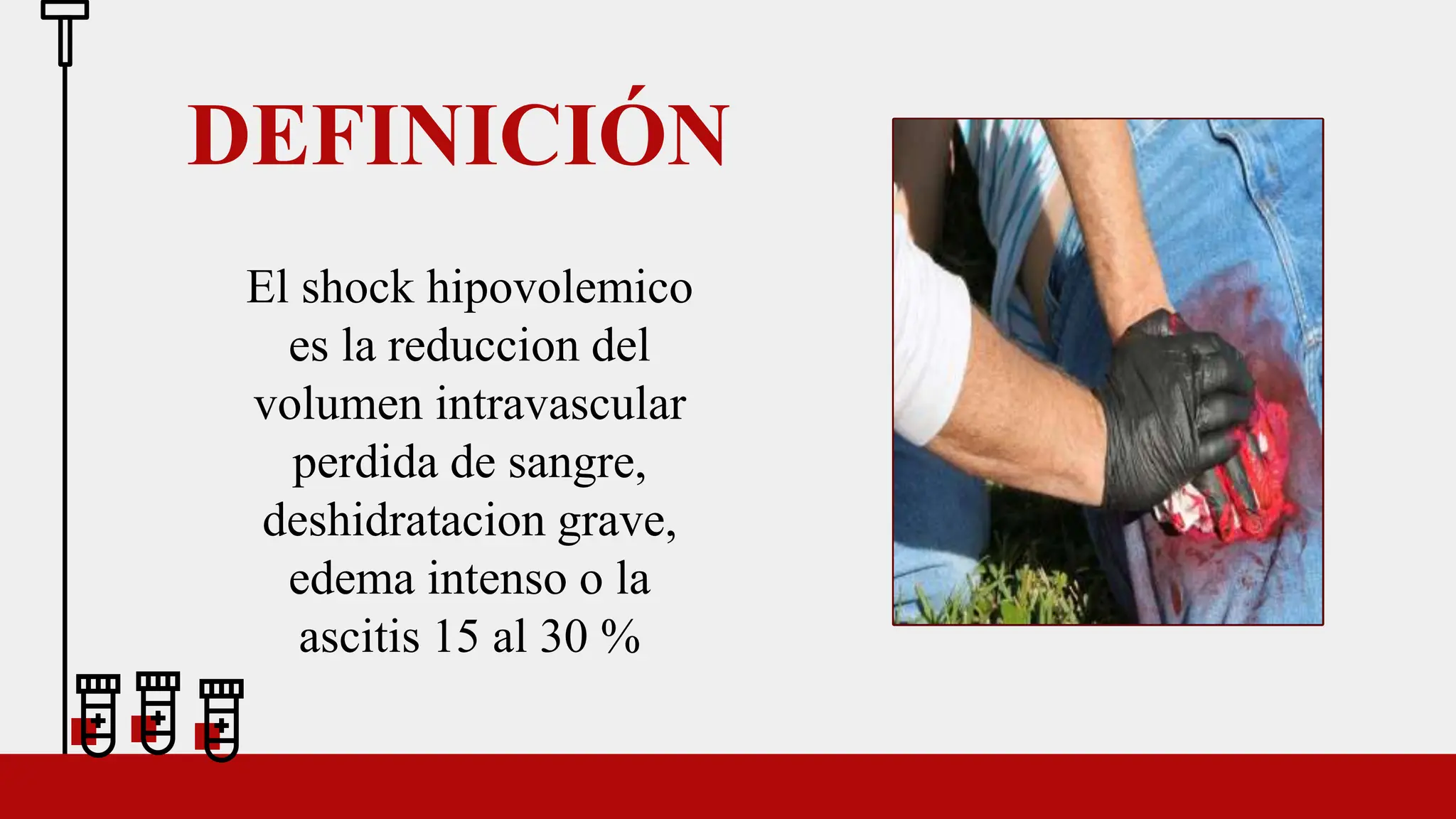 Tipos de Shock - Presentacion Oficial 1.0 (1).pptx