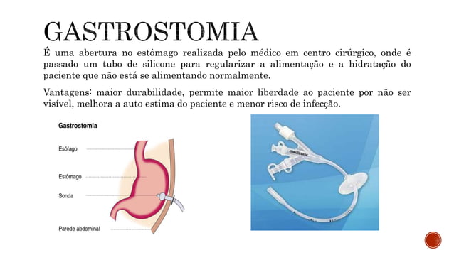 Tipos de sondas | PPT