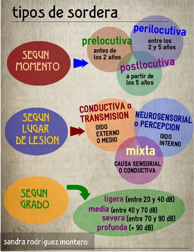Tratamiento Para La Sordera Definicin Tipos Y Mucho Ms