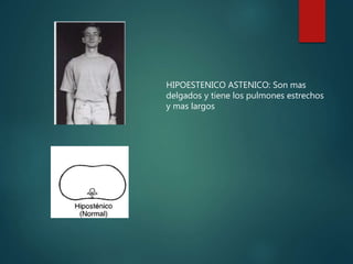 Tipos de torax | PPTX