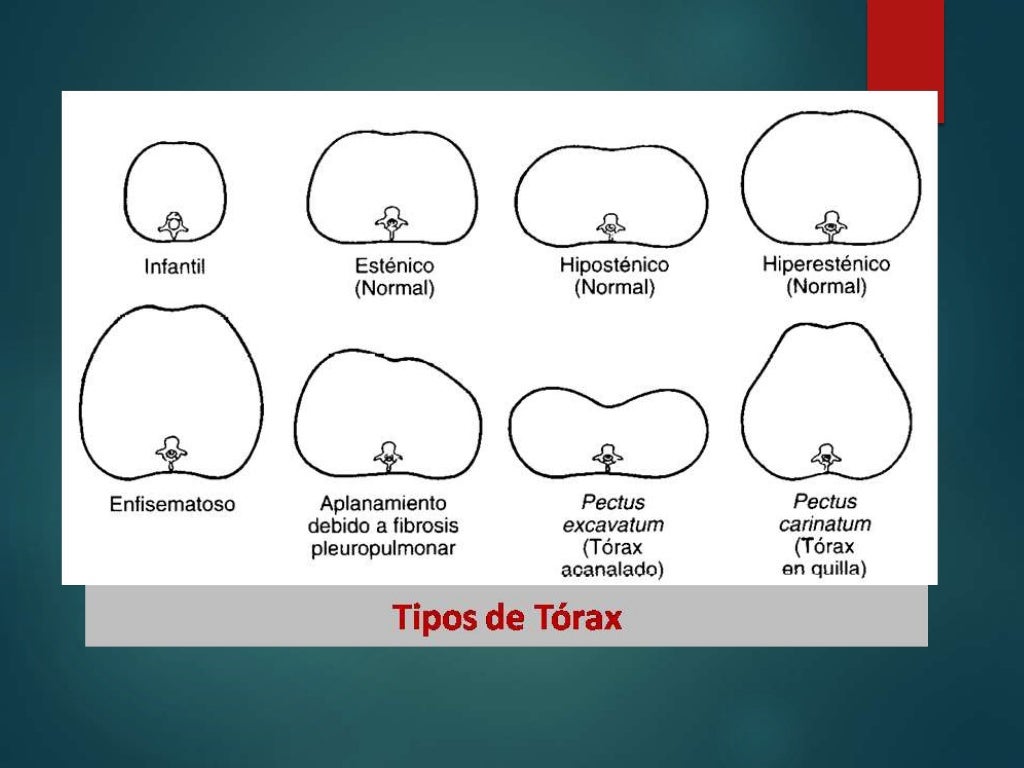 Tipos de torax