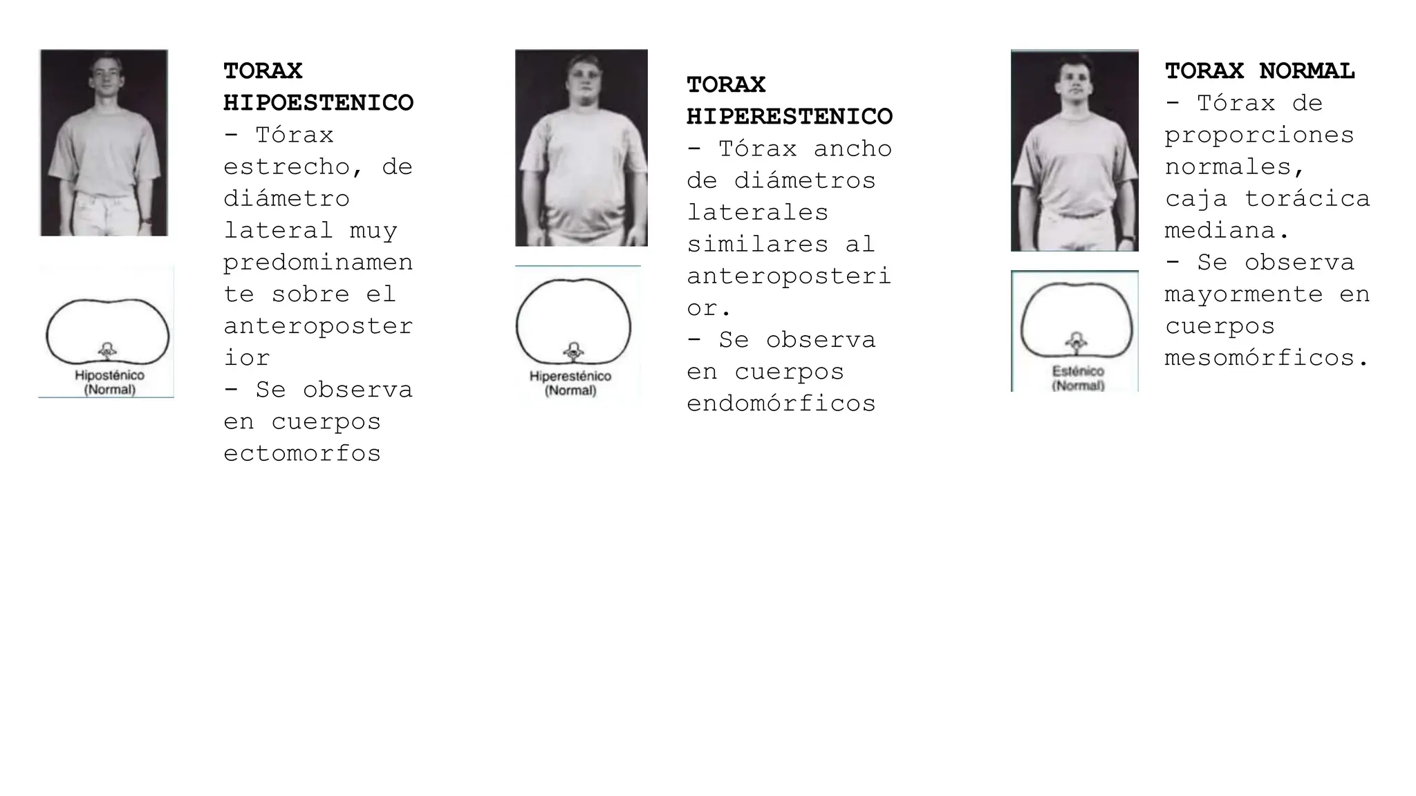 TIPOS DE TORAX, CLASIFICACION, TIPOS. PPTX | PPTX