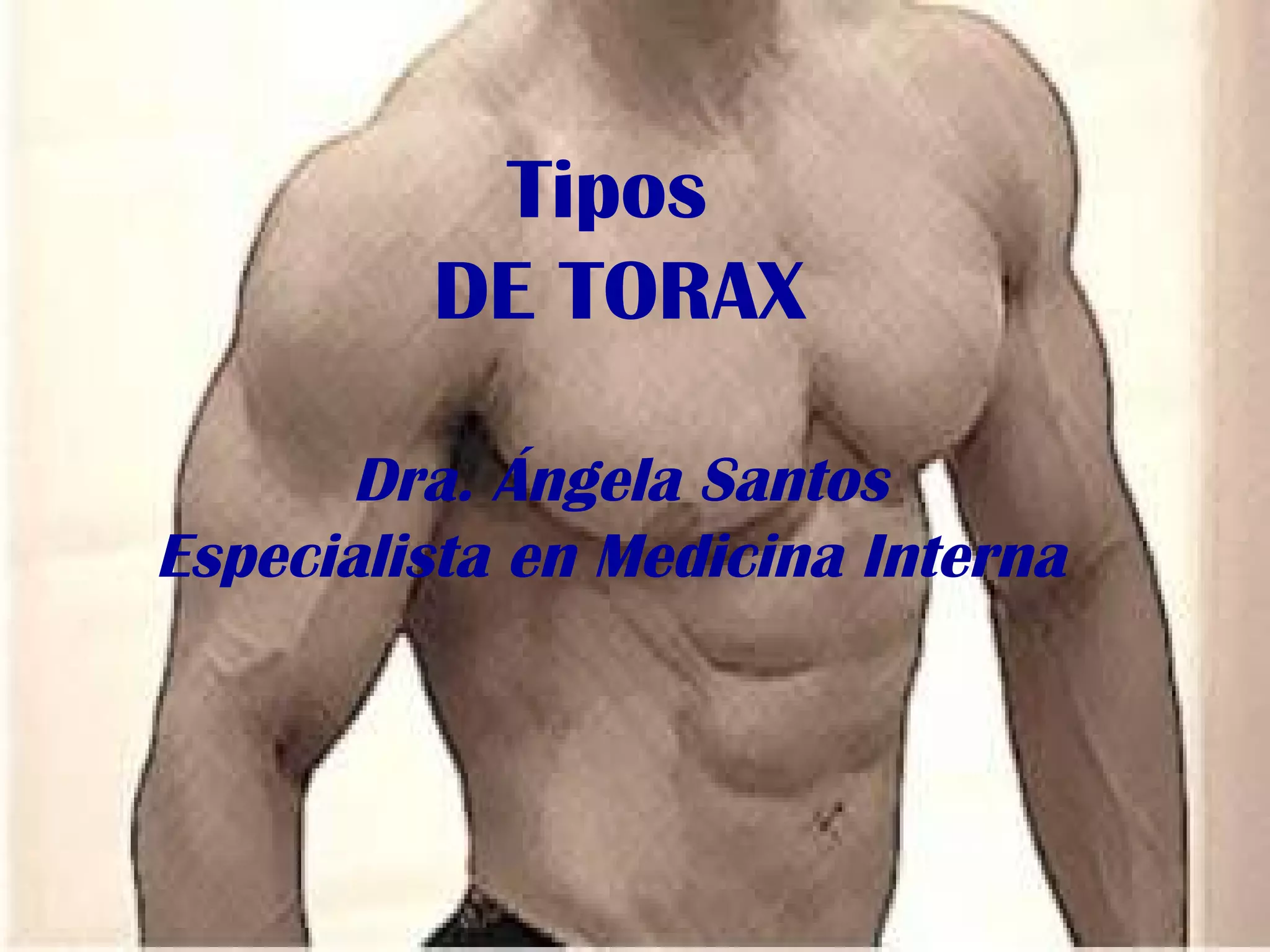 Tipos de tórax | PPT