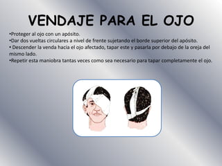 Tipos de vendajes | PPTX