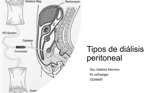 TIPOS DIALISIS PERITONEAL.pptx