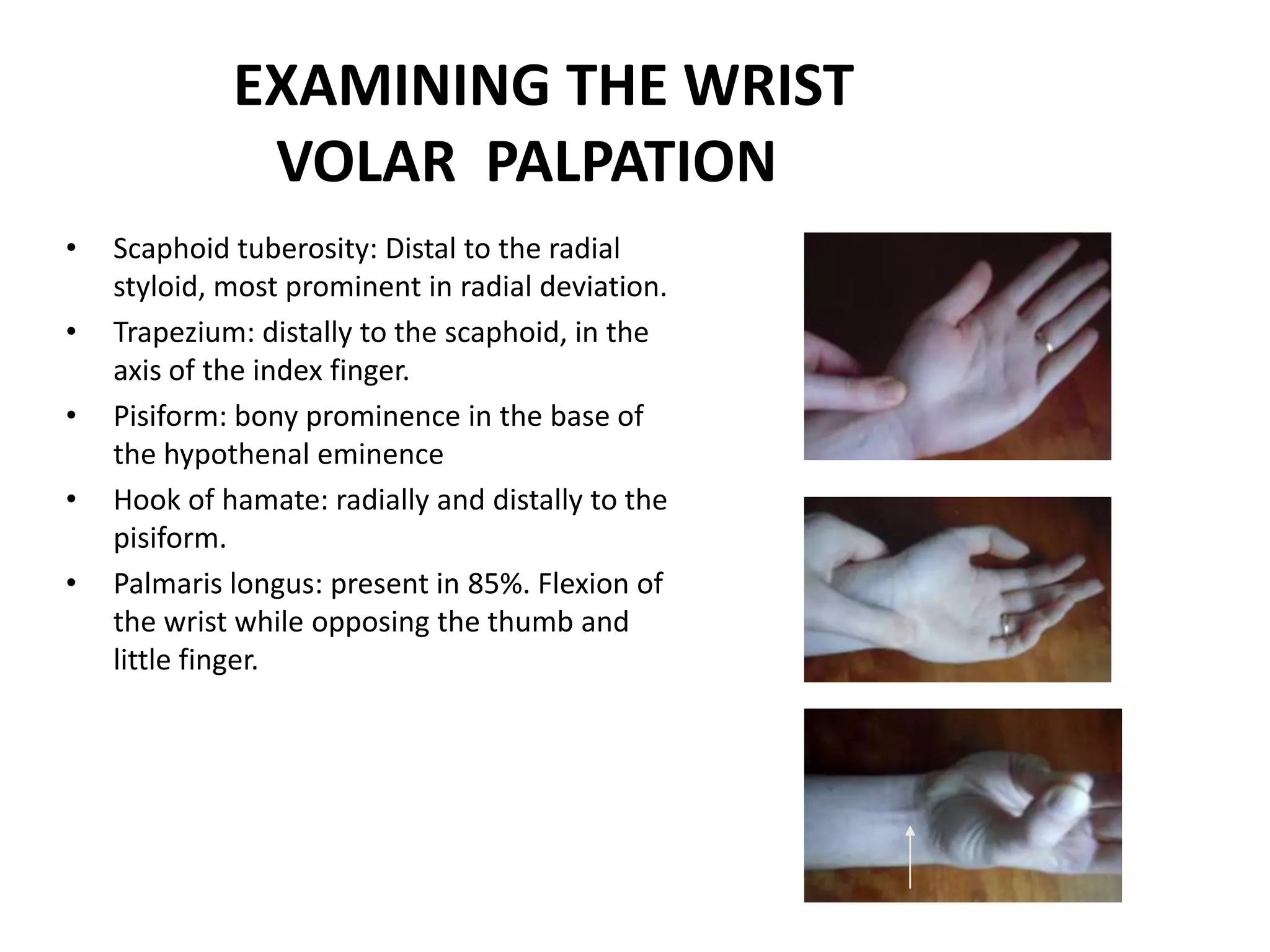 Tips on upper limb assessment | PPTX