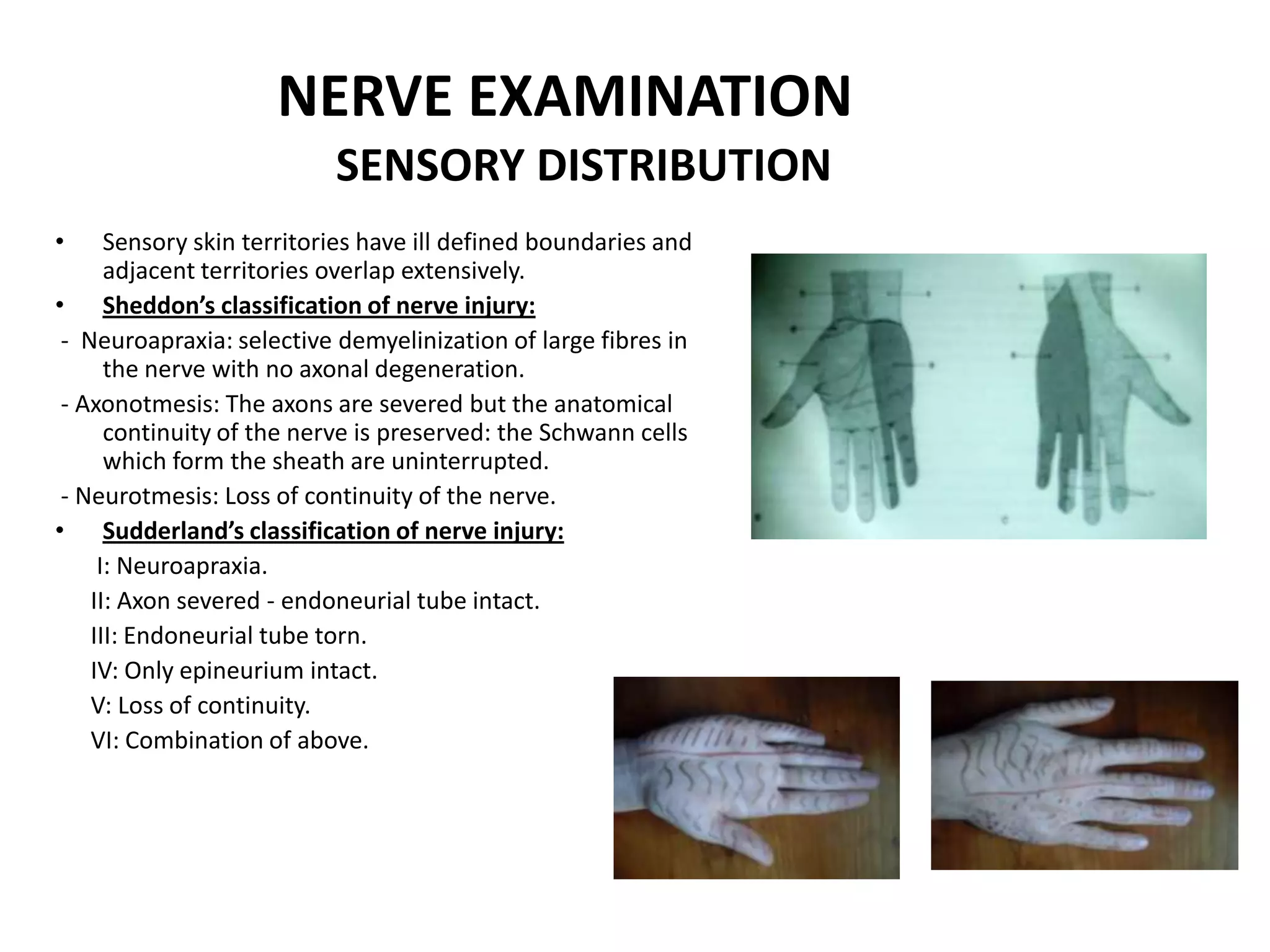 Tips on upper limb assessment | PPTX