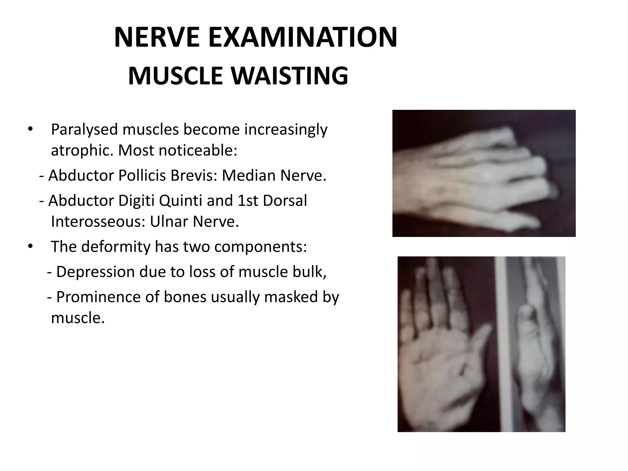 Tips on upper limb assessment | PPTX
