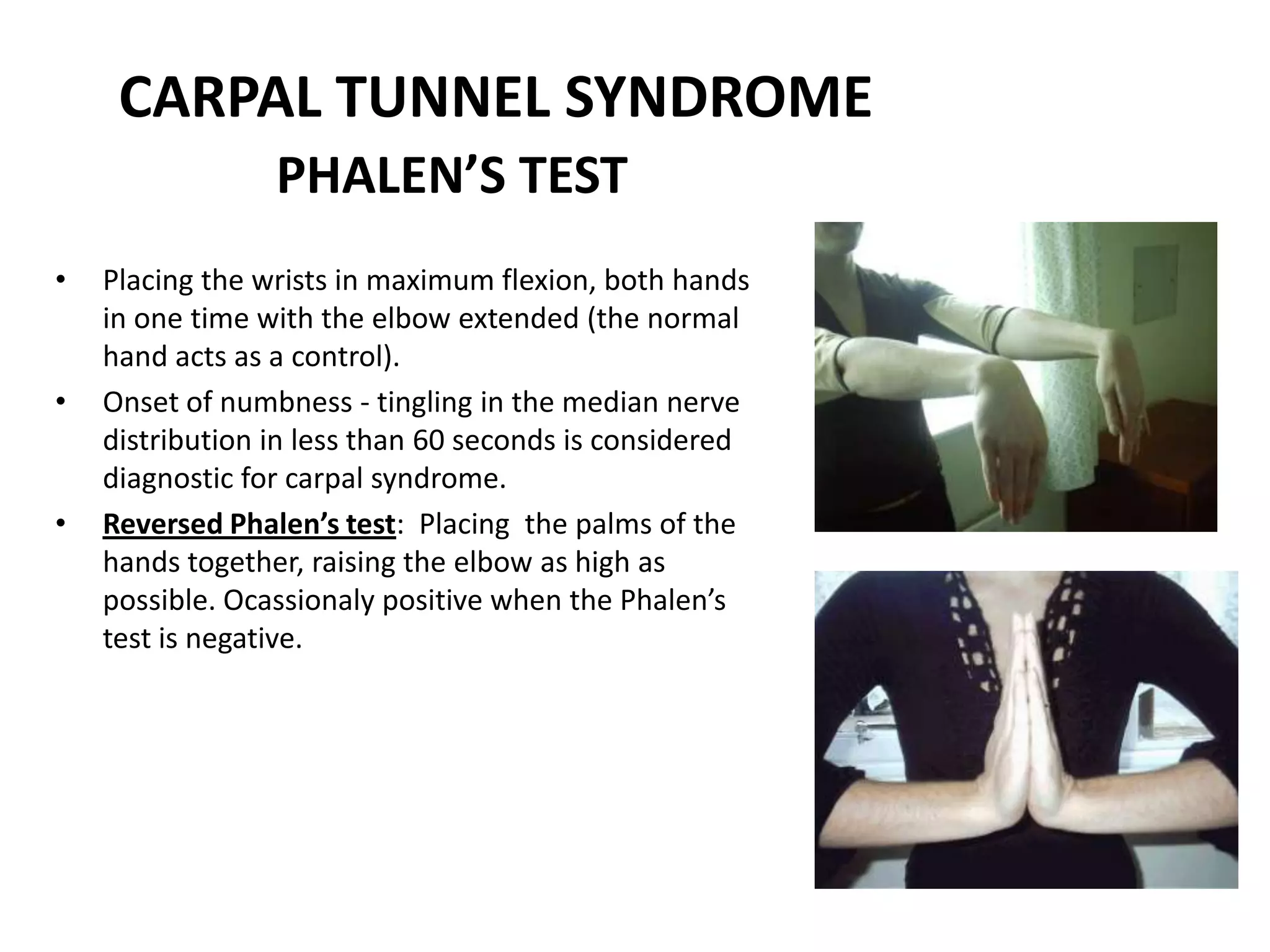 Tips on upper limb assessment | PPTX