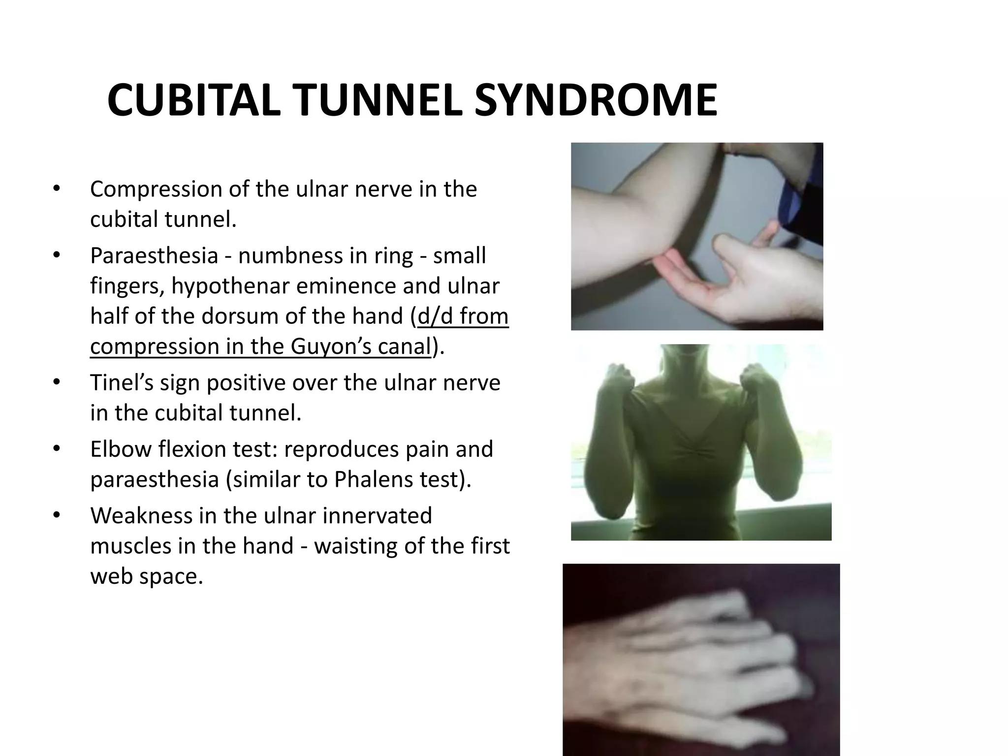Tips on upper limb assessment | PPTX