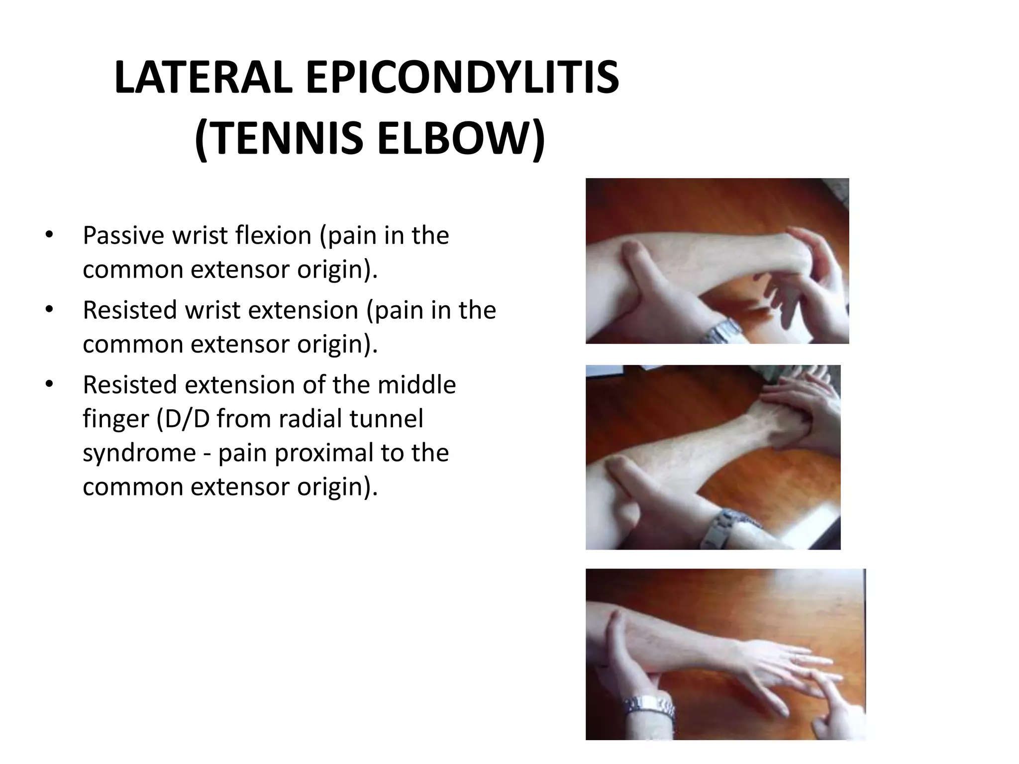 Tips on upper limb assessment | PPTX