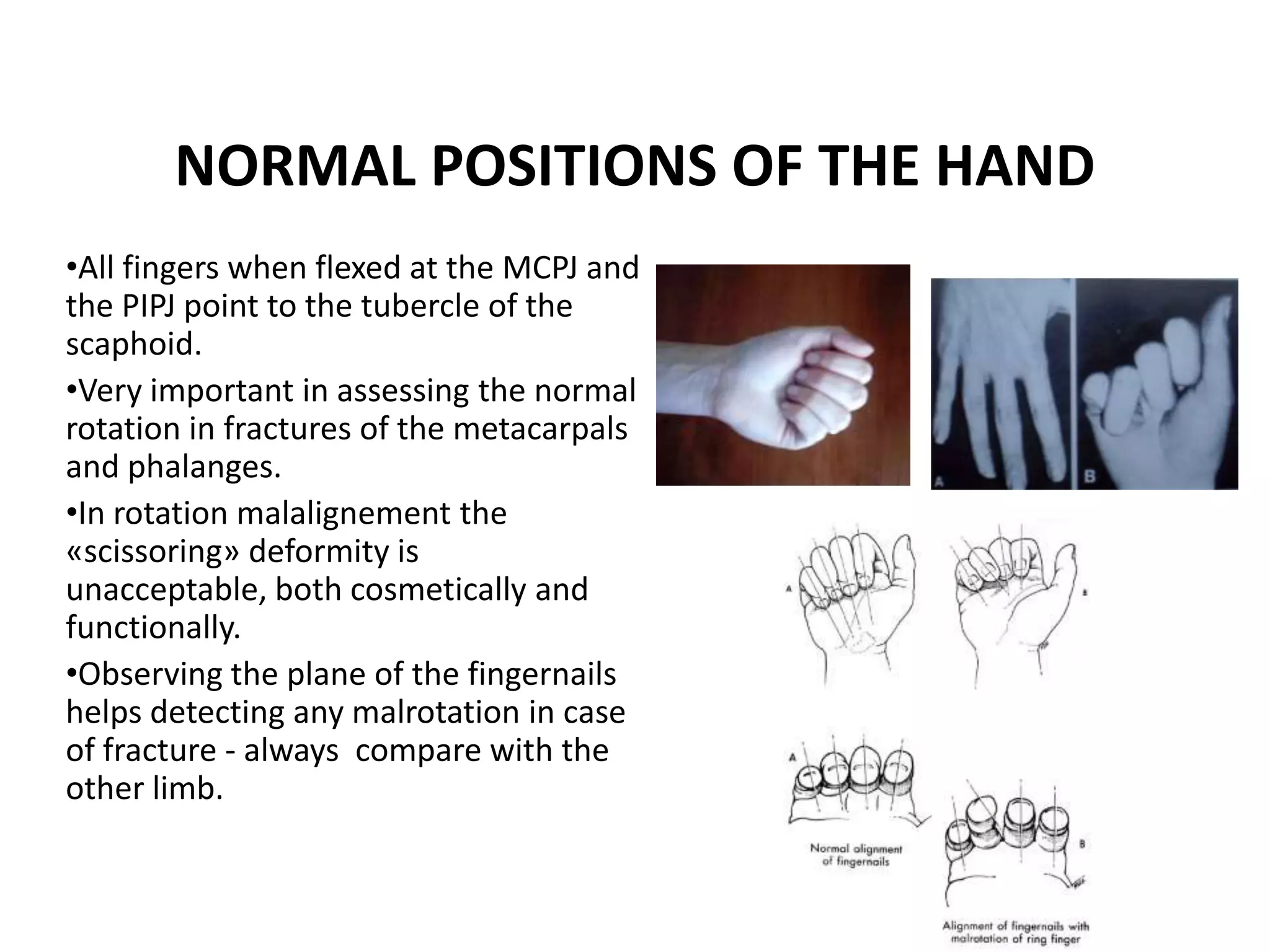 Tips on upper limb assessment | PPT