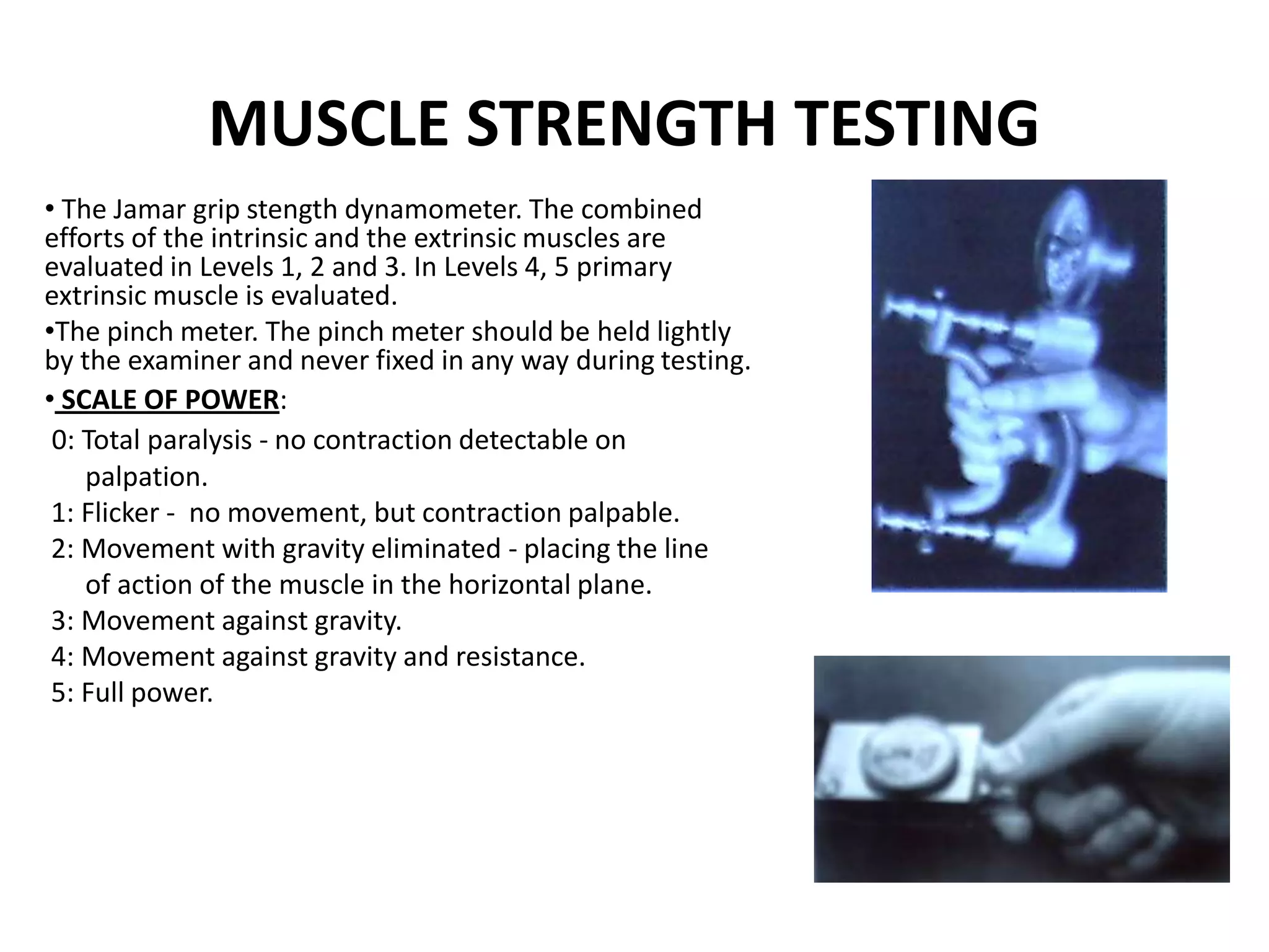 Tips on upper limb assessment | PPTX