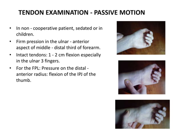Tips on upper limb assessment | PPTX