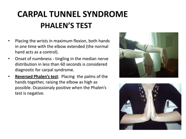 Tips on upper limb assessment | PPTX