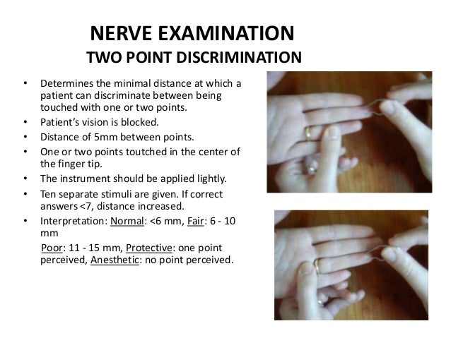 Tips on upper limb assessment