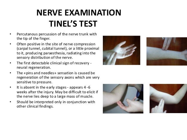 Radial Tunnel Syndrome Test Arm Pain Case Histories From The