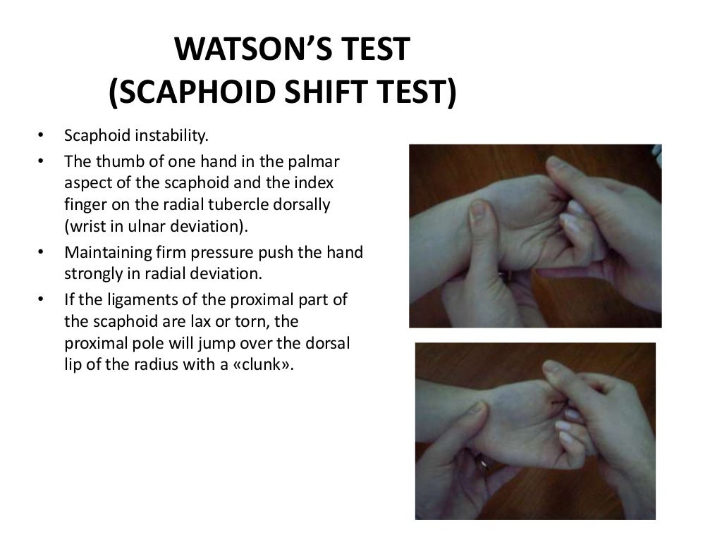 Tips on upper limb assessment
