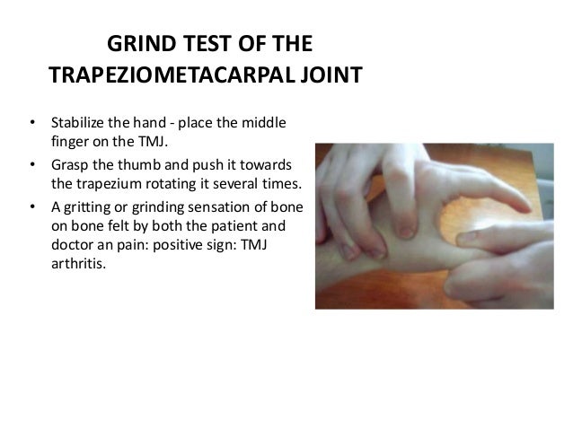 Tips on upper limb assessment