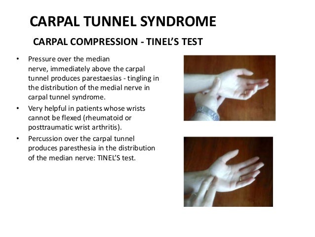 Tips on upper limb assessment