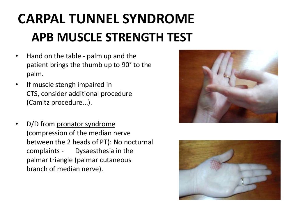 Tips on upper limb assessment