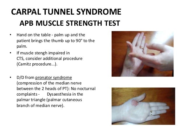 Tips on upper limb assessment