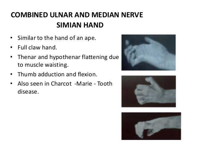 Tips on upper limb assessment