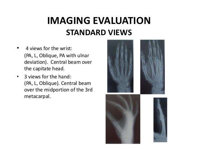 Tips on upper limb assessment