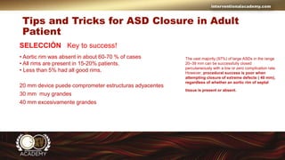Tips and Tricks for ASD Closure in Adult.pptx