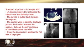Tips and Tricks for ASD Closure in Adult.pptx